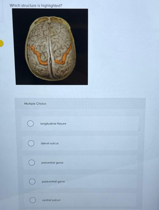Solved The structure highlighted represents? Multiple Choice | Chegg.com