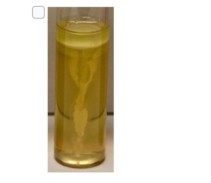 Solved Which bacteria reduce Sulfur? (Select all that | Chegg.com