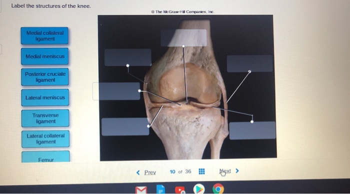 Solved: Label The Structures Of The Knee. The McGraw Compa... | Chegg.com