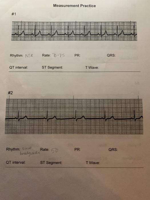 Solved Measurement Practice #1 رہ Rhythm: NSR Rate: 70-75 | Chegg.com