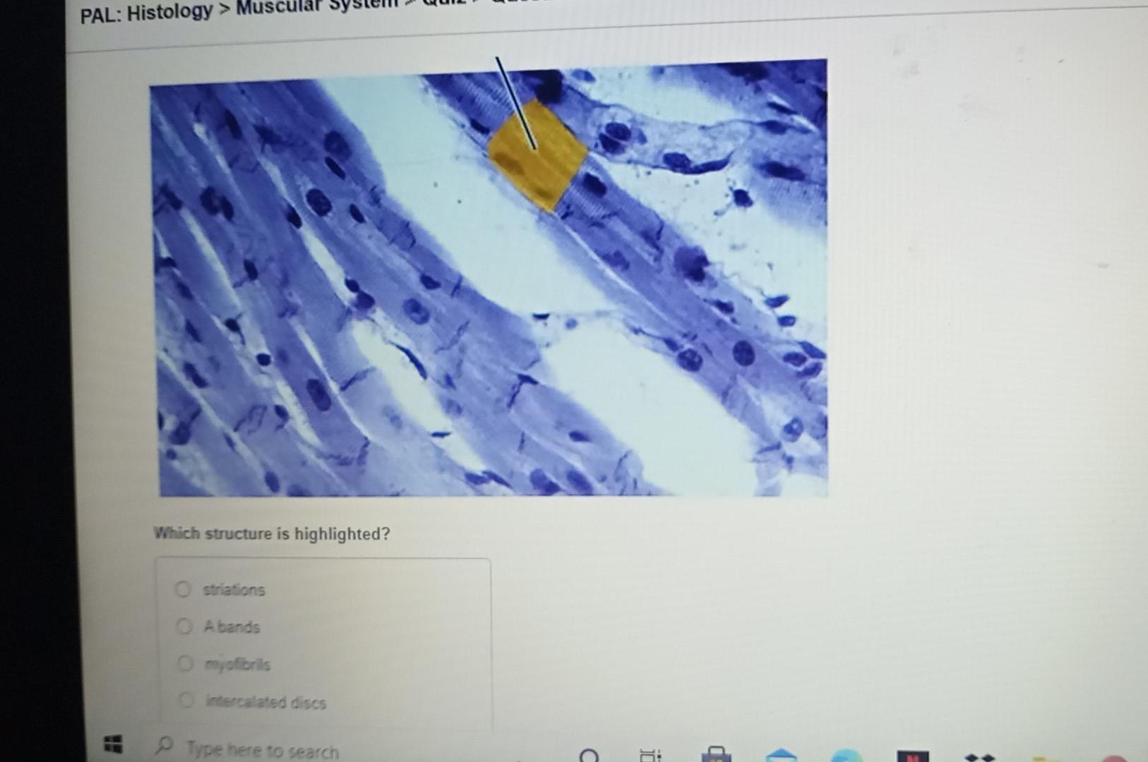 Solved PAL: Histology > Muscular sy! Which structure is | Chegg.com