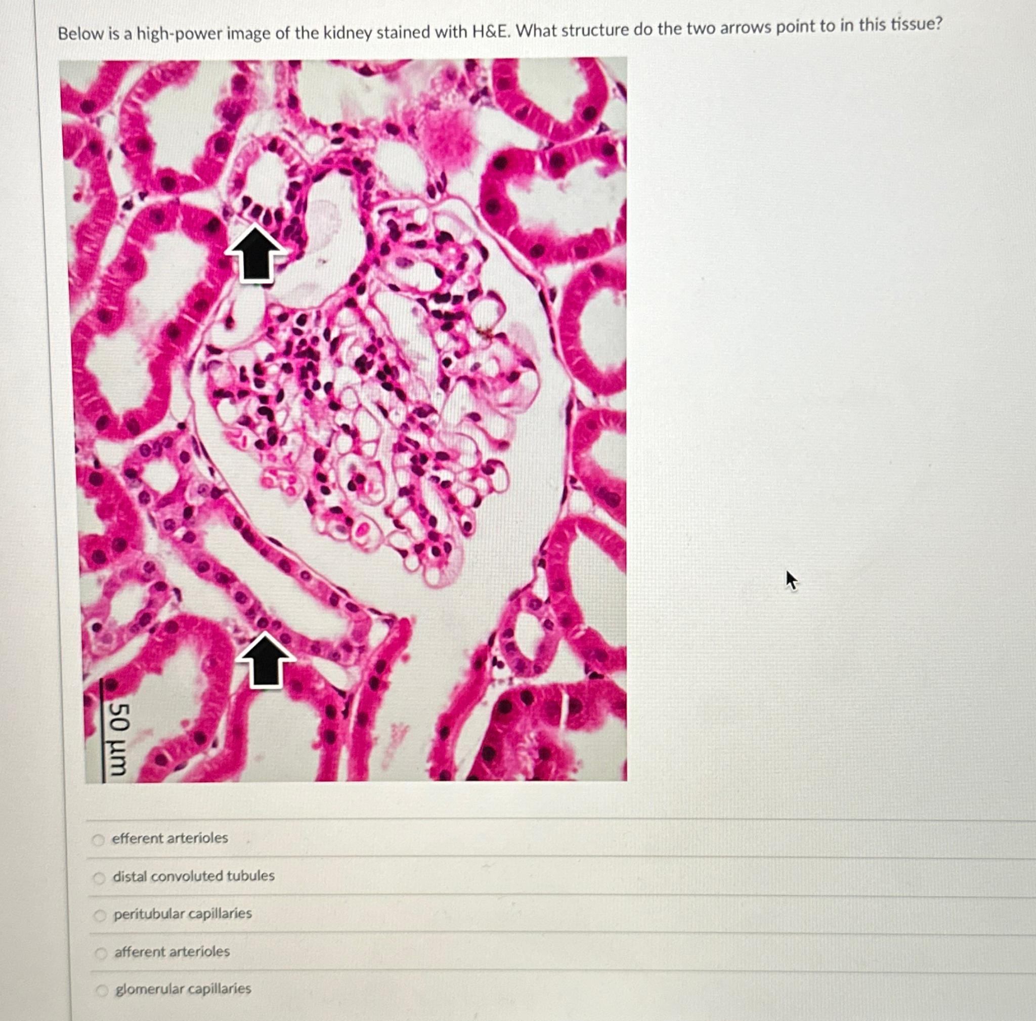 Solved Below is a high-power image of the kidney stained | Chegg.com