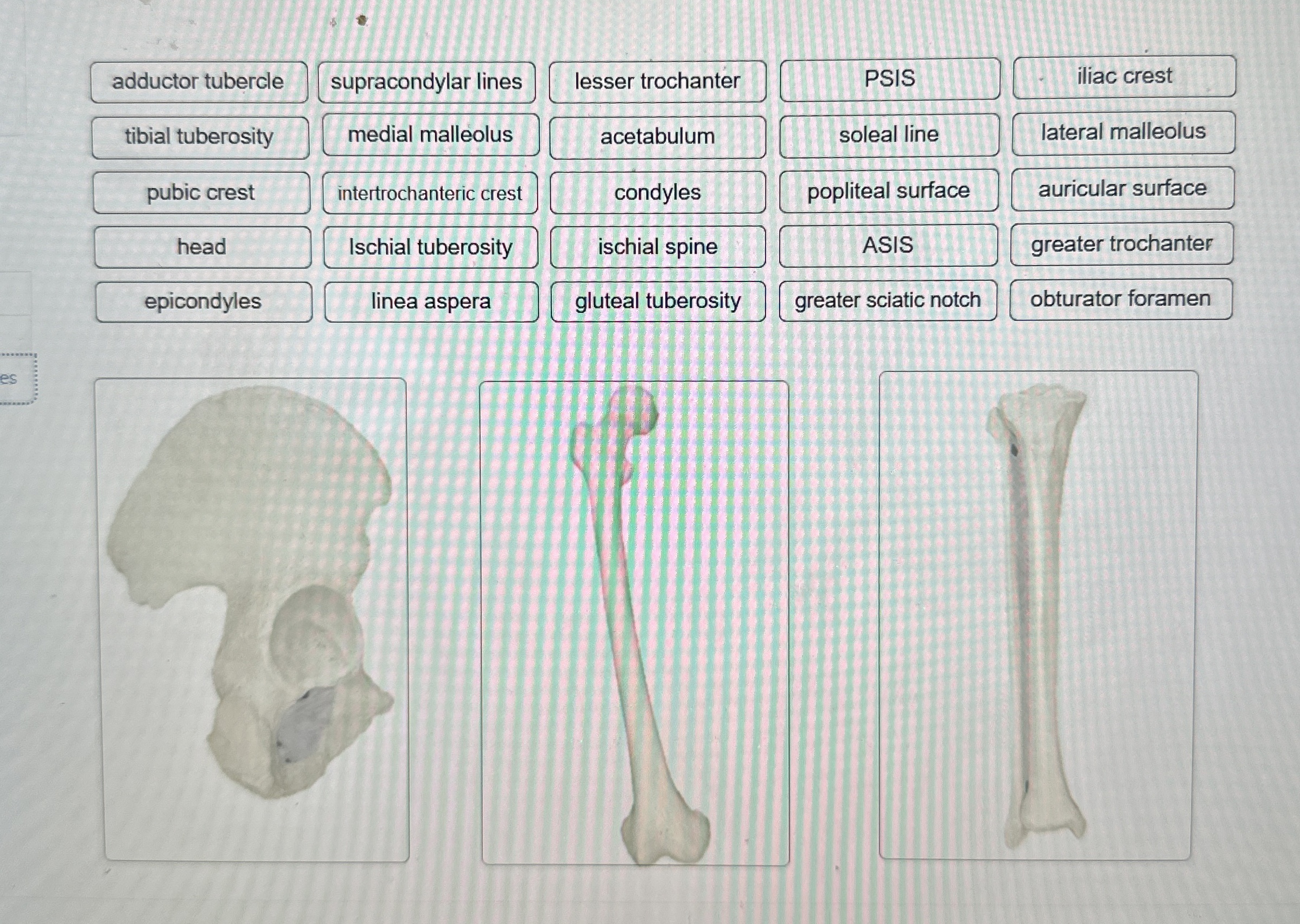 Solved Place the following parts of a bone with the | Chegg.com