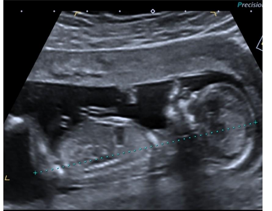 Each ultrasound image has a part of the fetal anatomy | Chegg.com