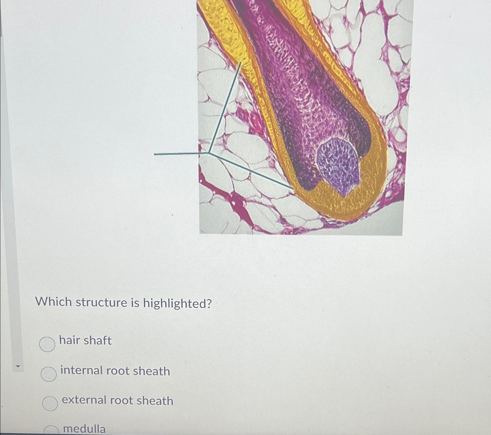 Solved Which structure is highlighted?hair shaftinternal | Chegg.com
