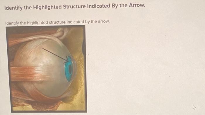 Solved Identify the Highlighted Structure Indicated By the | Chegg.com Solved Identify the Highlighted Structure Indicated By the | Chegg.com