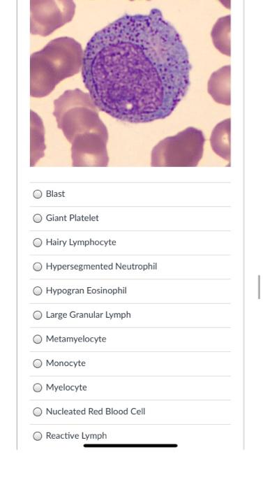 Solved Blast Giant Platelet Hairy Lymphocyte Hypersegmented | Chegg.com