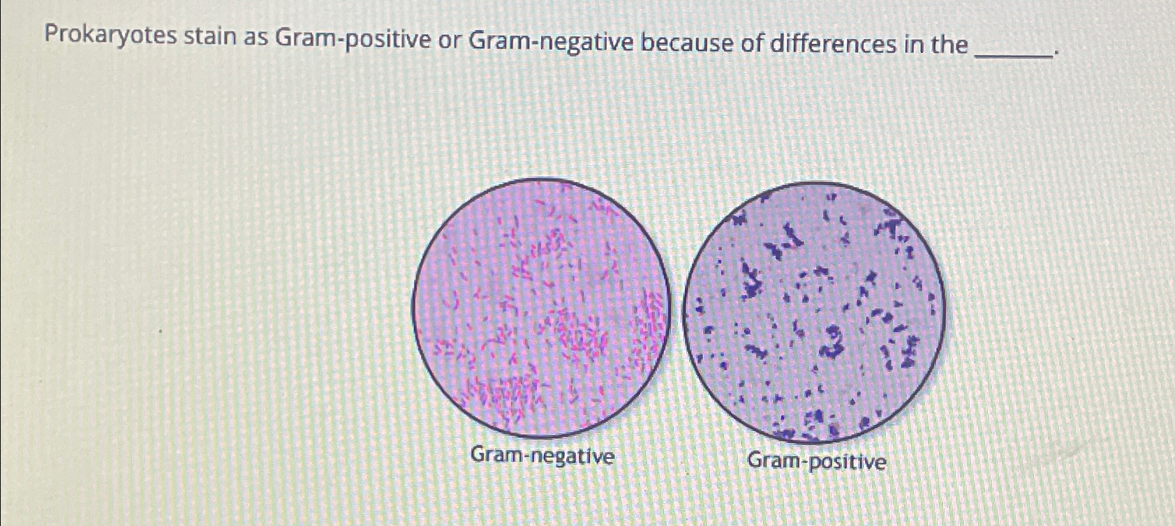 Solved Prokaryotes stain as Gram-positive or Gram-negative | Chegg.com