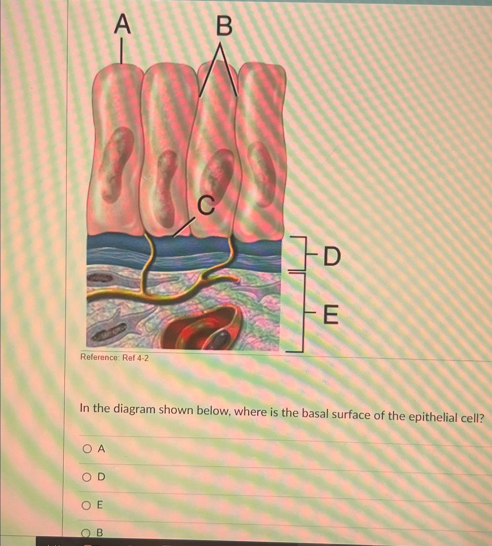 Solved In the diagram shown below, where is the basal | Chegg.com