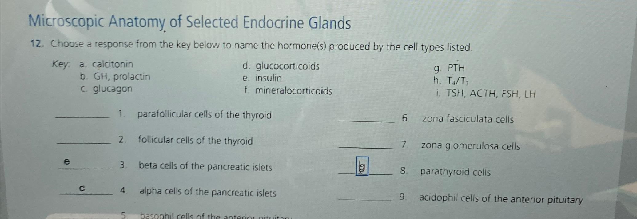 Solved Microscopic Anatomy of Selected Endocrine Glands12. | Chegg.com