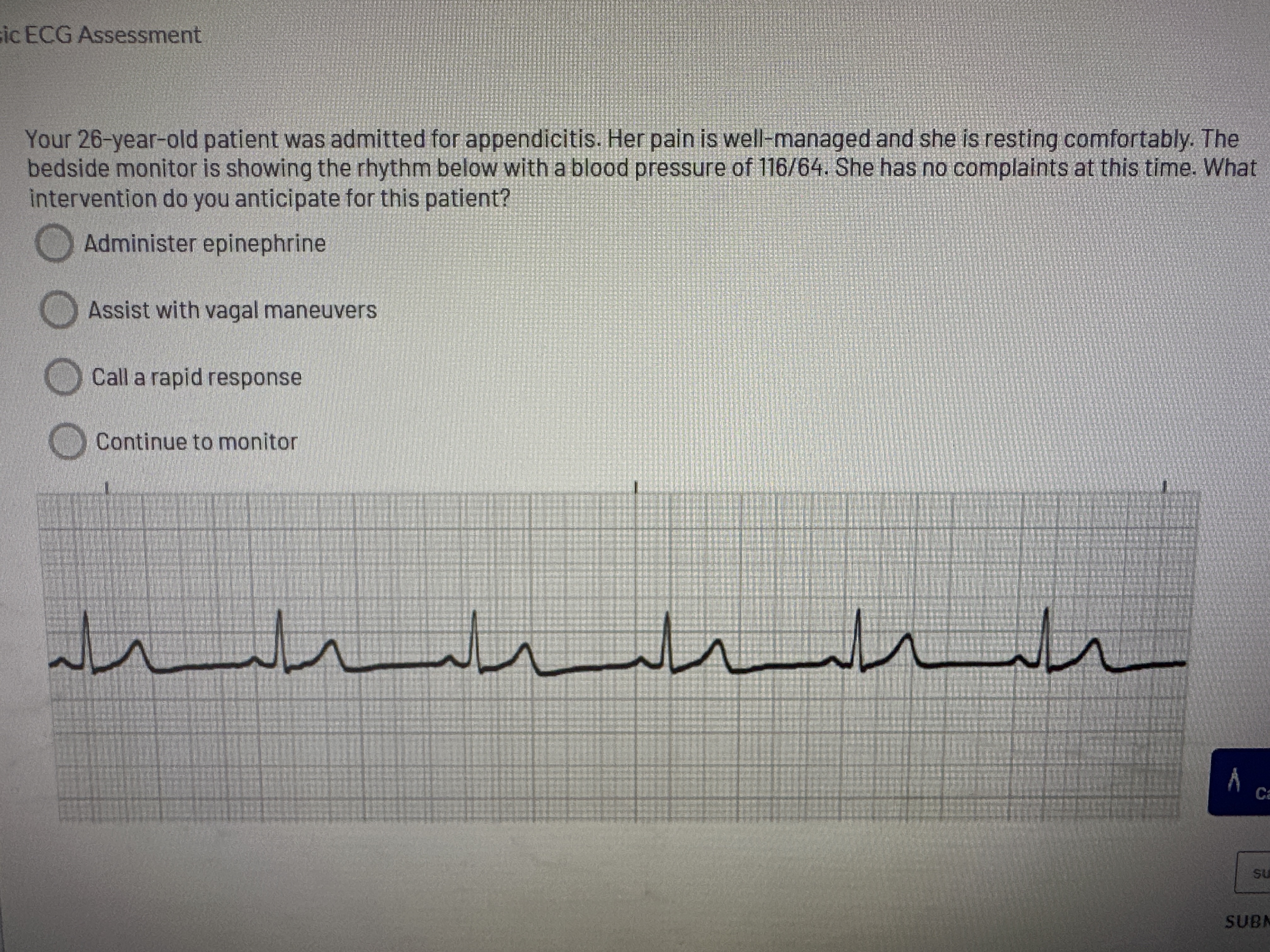 Solved ic ECG Assessment Your 26 -year-old patient was | Chegg.com
