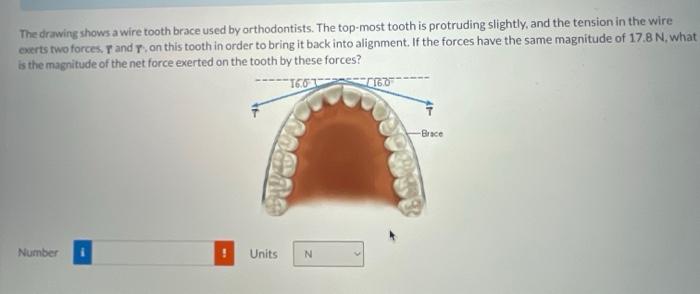 Solved The drawing shows a wire tooth brace used by | Chegg.com