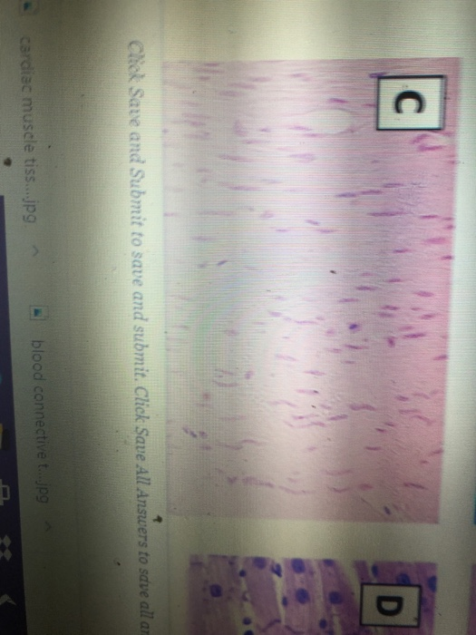 Solved с adipose loose connective tissue areolar loose | Chegg.com