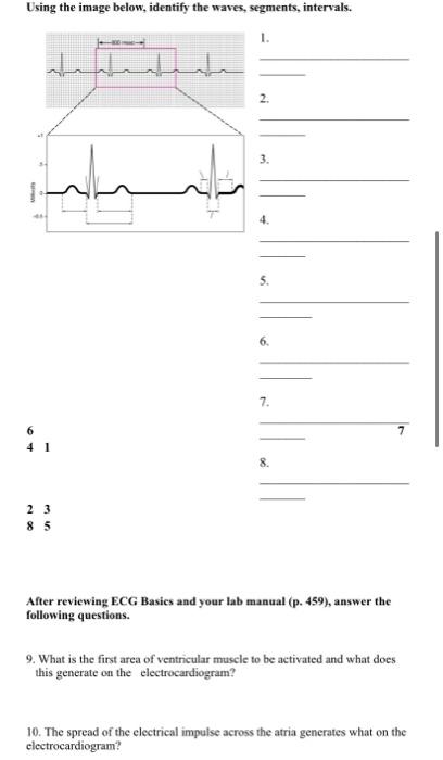 Solved Cardiovascular Physiology: Electrocardiography Follow | Chegg.com