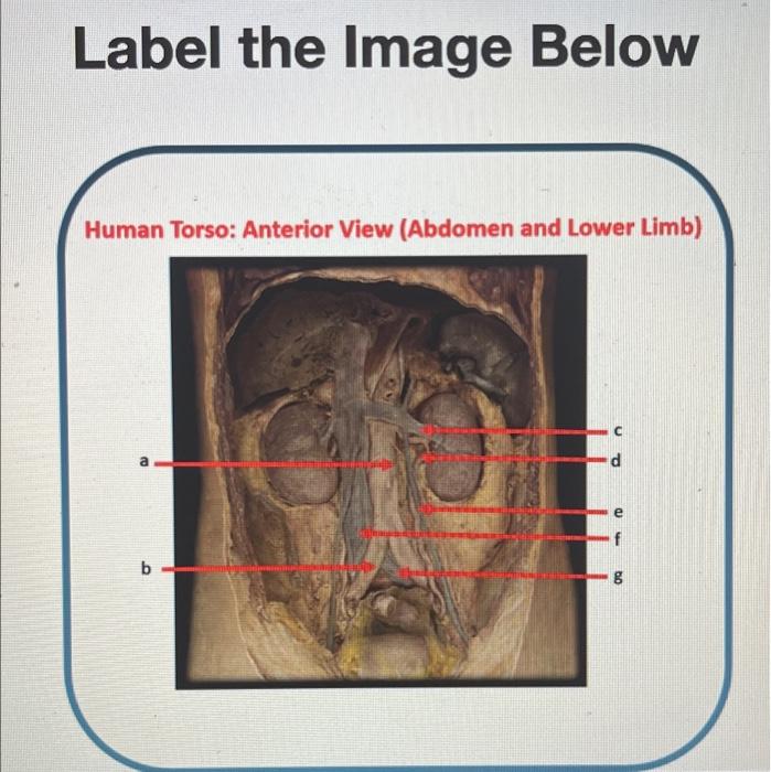 Solved Label the Image Below Human Torso: Anterior View | Chegg.com