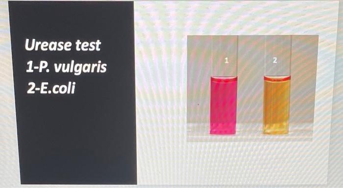 Solved Urease test-Looking at the resulis presentation | Chegg.com