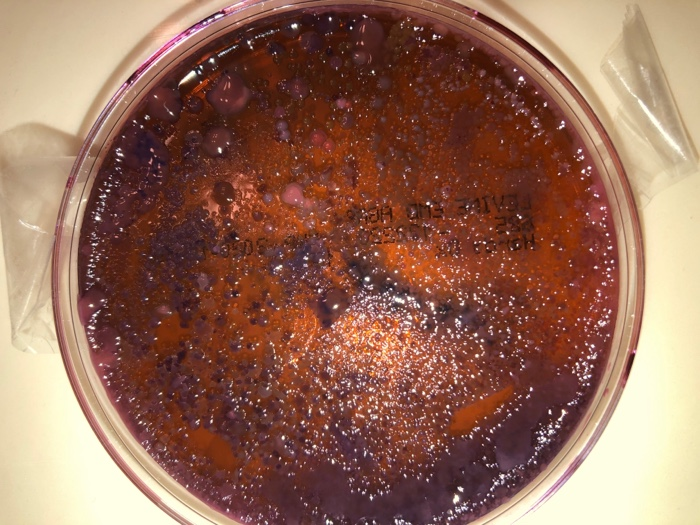 Solved 2) Confirmed test - EMB plate a) Picture of your EMB | Chegg.com