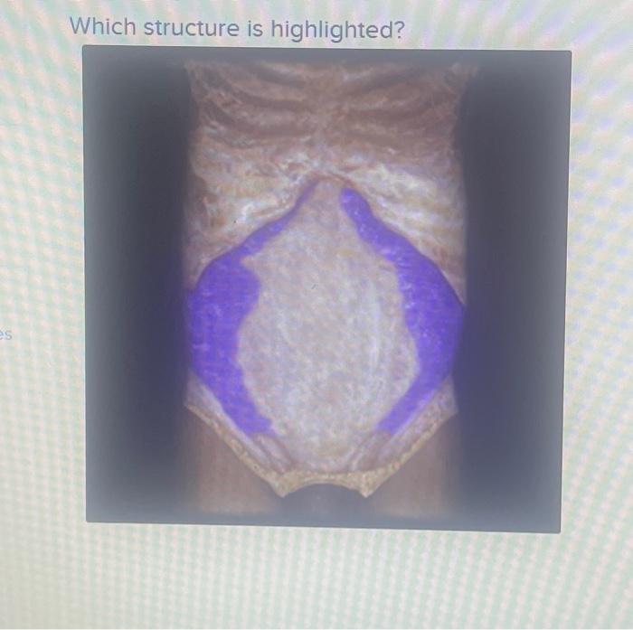 Solved Which structure is highlighted? | Chegg.com