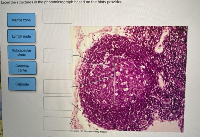 Solved Label The Structures In The Photomicrograph Based On