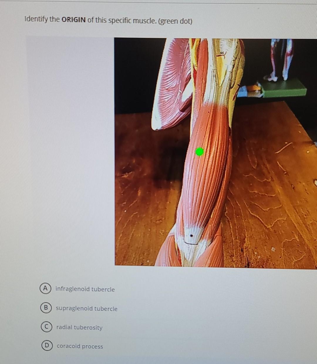Solved Identify the ORIGIN of this specific musde. (green | Chegg.com