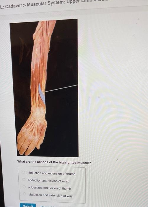 Solved What are the actions of the highlighted muscle? | Chegg.com