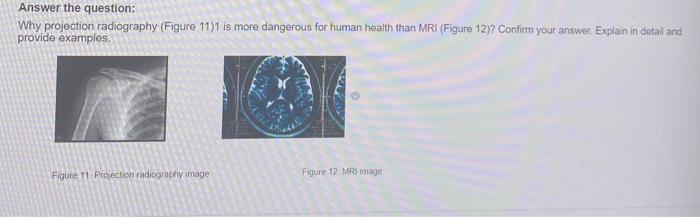 Solved Why projection radiography (Figure 11)1 is more | Chegg.com