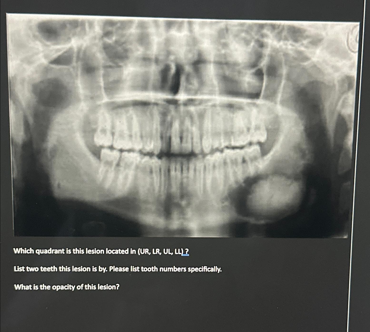 Solved Which quadrant is this lesion located in (UR, ﻿LR, | Chegg.com