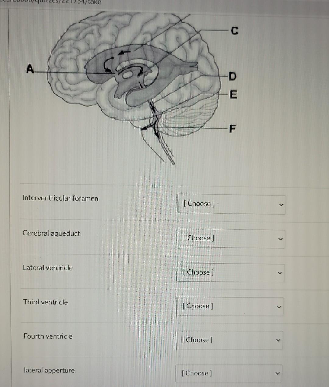 Solved Interventricular foramen Cerebral aqueduct Lateral | Chegg.com