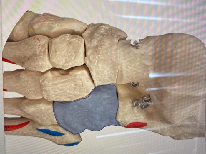 Solved Cuboid Lateral cuneiform Navicular Intermediate | Chegg.com