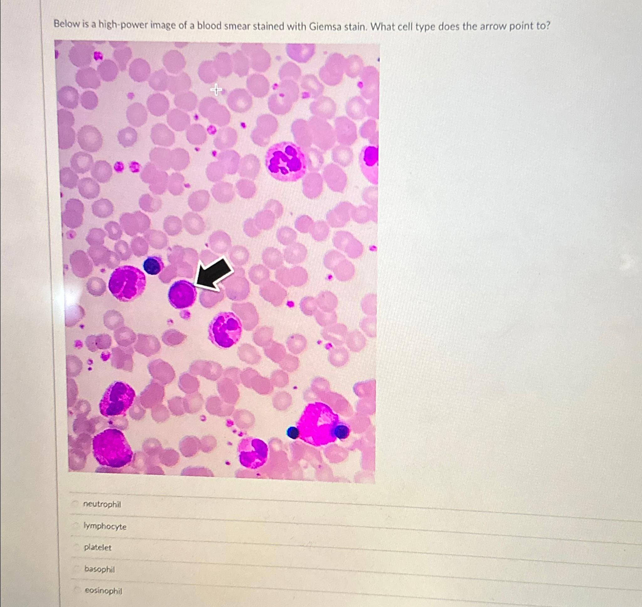 Solved Below is a high-power image of a blood smear stained | Chegg.com