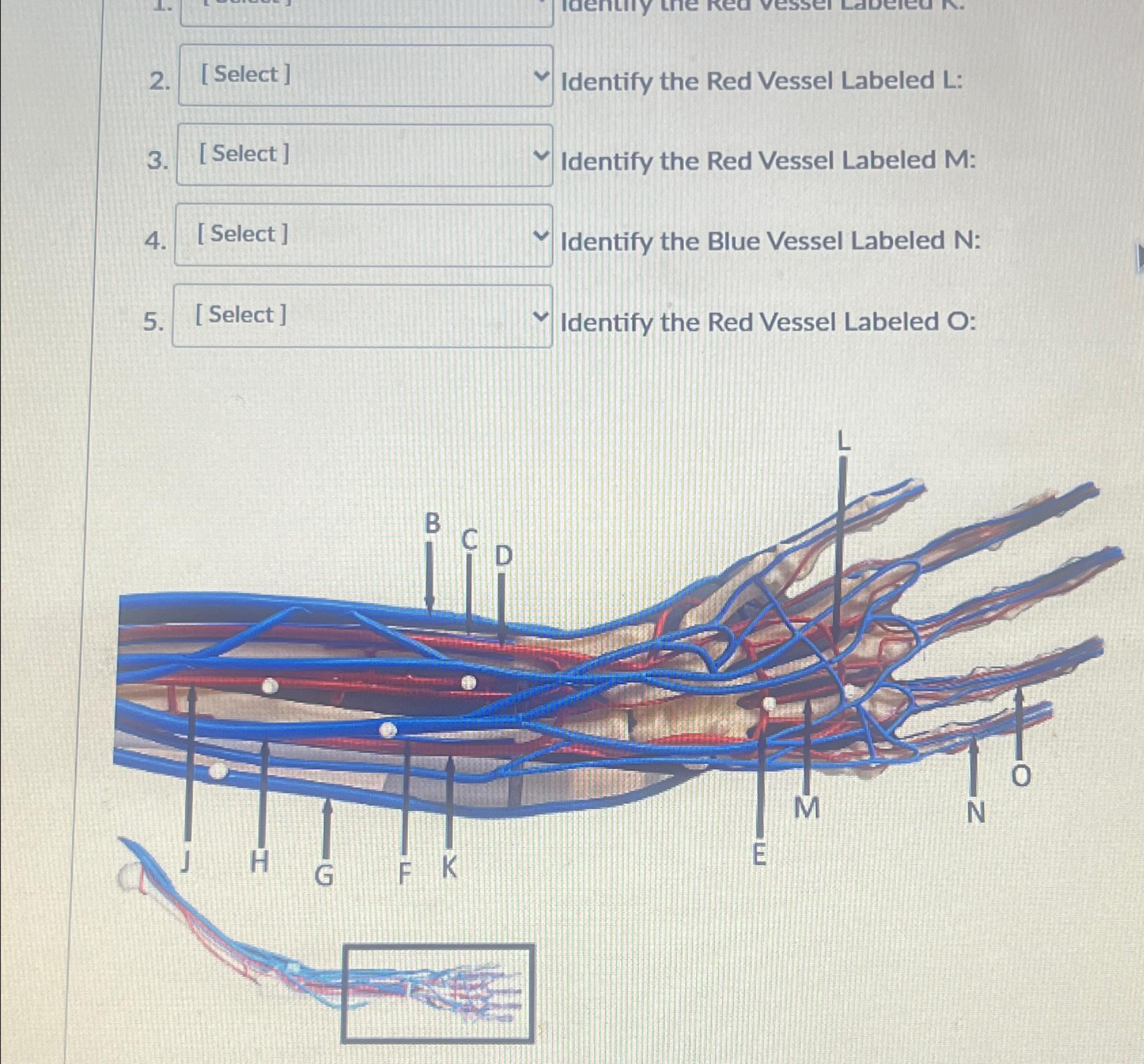 Solved Identify the Red Vessel Labeled L:Identify the Red | Chegg.com