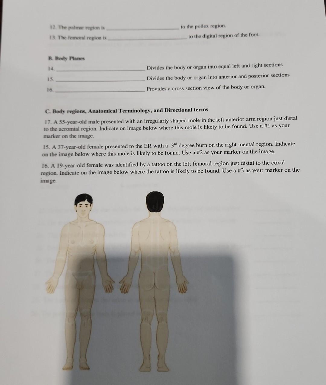 Solved 12. The palmar region is 13. The femoral region is B. | Chegg.com