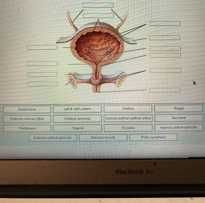 Solved Ischial bone Left & right ureters Urethra Rugao | Chegg.com