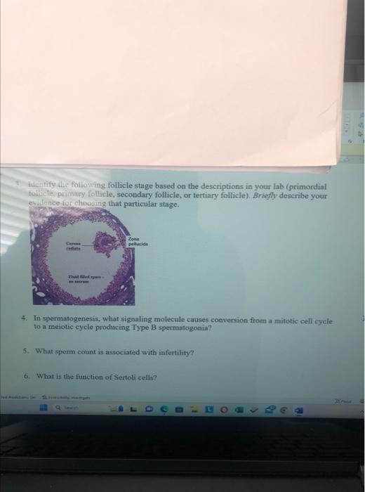 Solved ikertify the folioving follicle stage based on the | Chegg.com