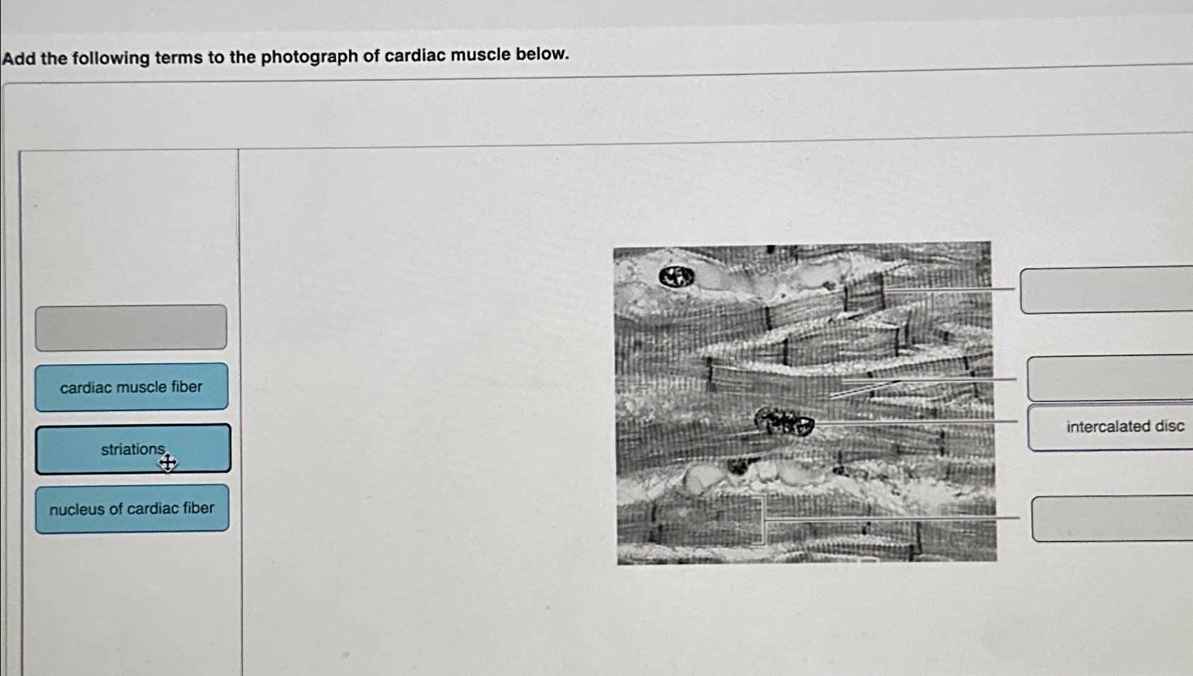 Solved Add the following terms to the photograph of cardiac | Chegg.com