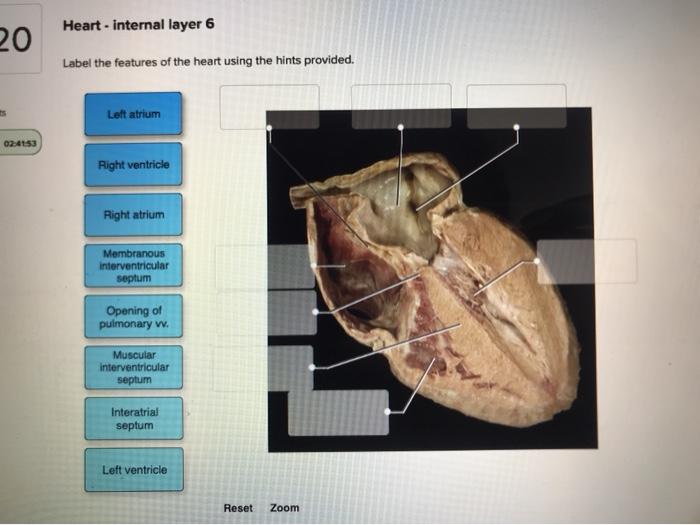 Solved Heart - internal layer 6 20 Label the features of the | Chegg.com