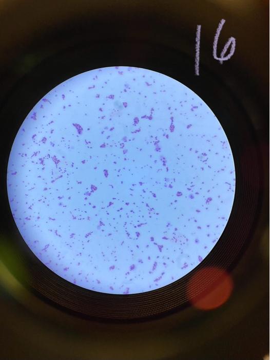 Solved 3. Insert an image of your gram stain smear. Label on | Chegg.com