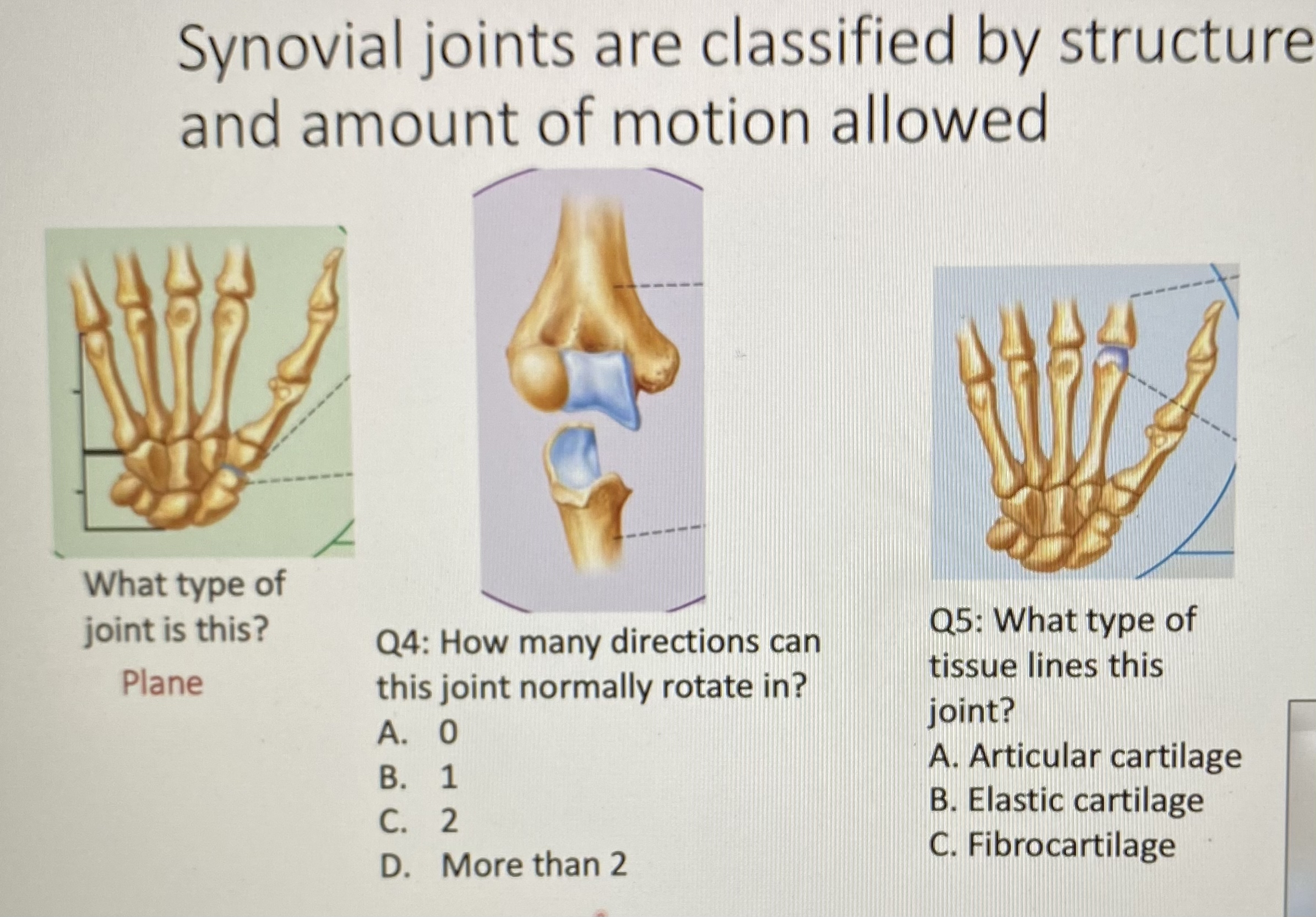 Solved Synovial joints are classified by structure and | Chegg.com
