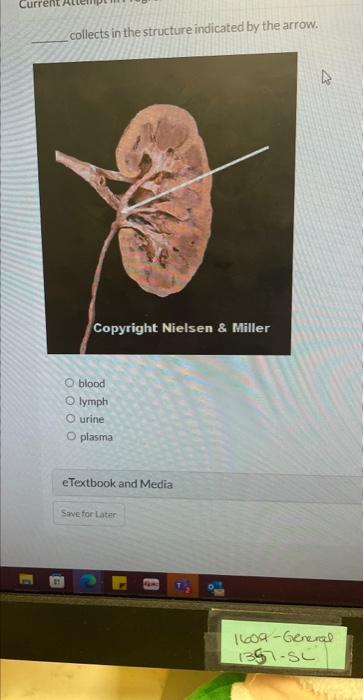 Solved collects in the structure indicated by the arrow. | Chegg.com