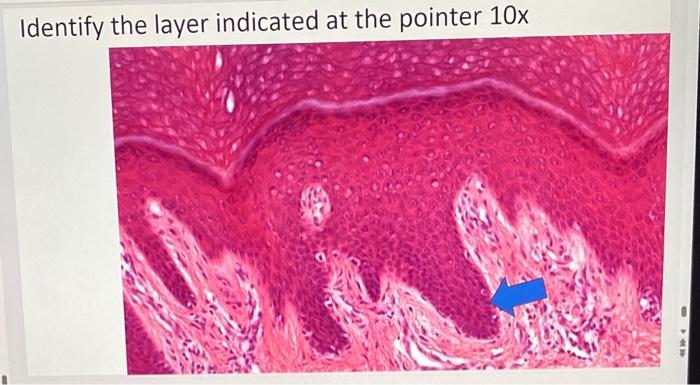 Solved Identify the layer indicated at the pointer 10x | Chegg.com