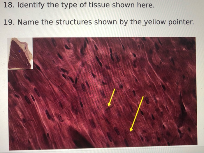 Solved 1. Identify the type of tissue marked by the yellow | Chegg.com