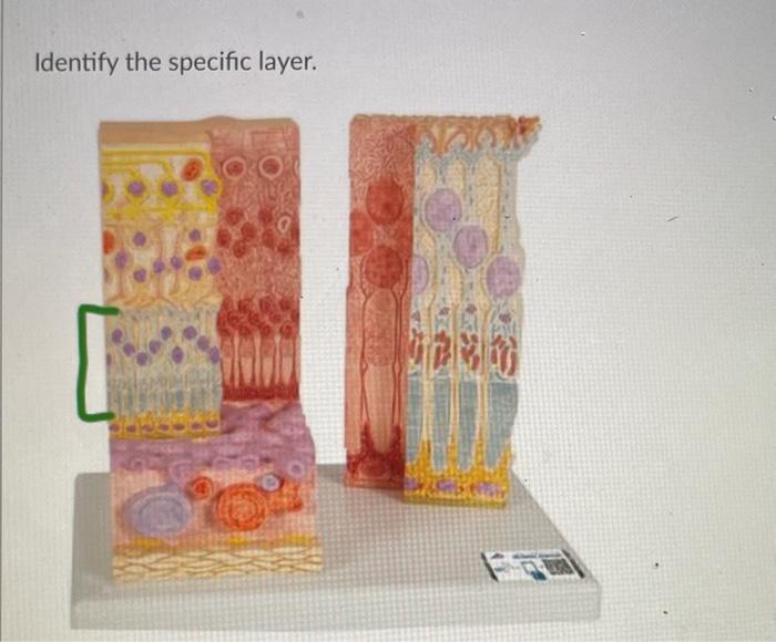 Solved Identify the specific layer. | Chegg.com