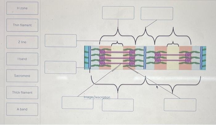 Solved Thin filament Zline Iband Sacromere Thick filament A | Chegg.com