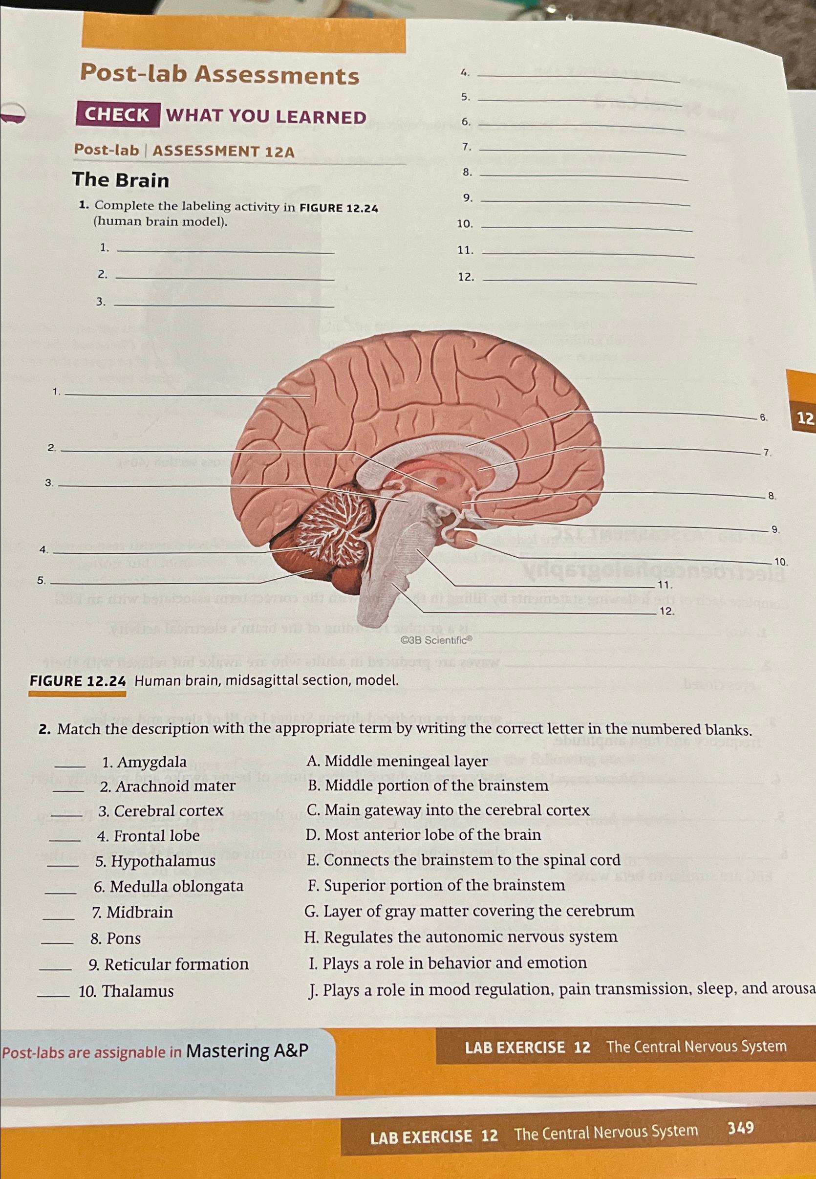 Solved Post-lab Assessments4. ﻿CHECK WHAT YOU | Chegg.com