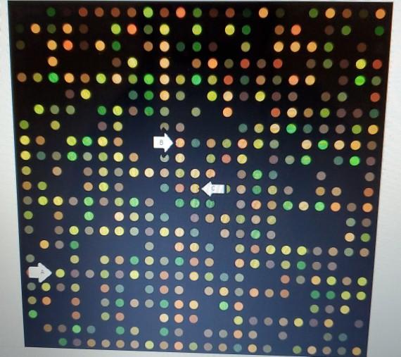 Solved A DNA microarray was hybridized with a mixture of two | Chegg.com