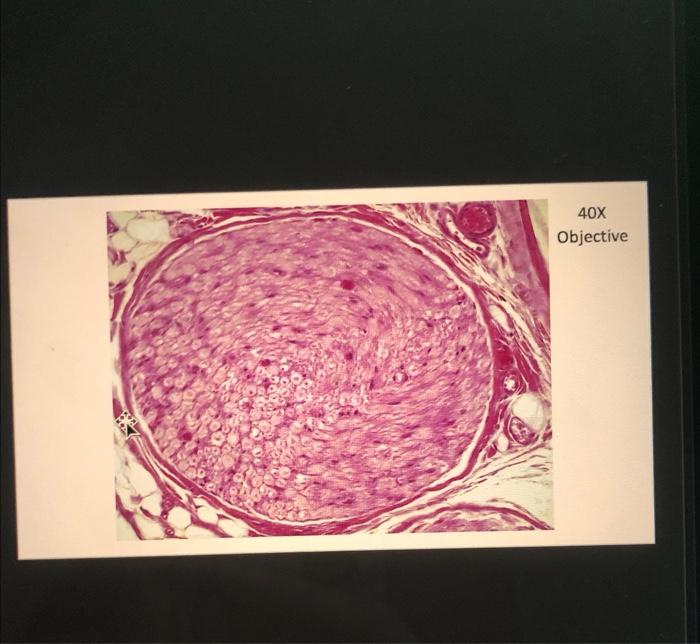 Solved 40X Objective | Chegg.com