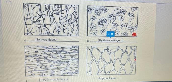 Solved 13. Twelve tissue types are diagrammed in Figure 3-6. | Chegg.com