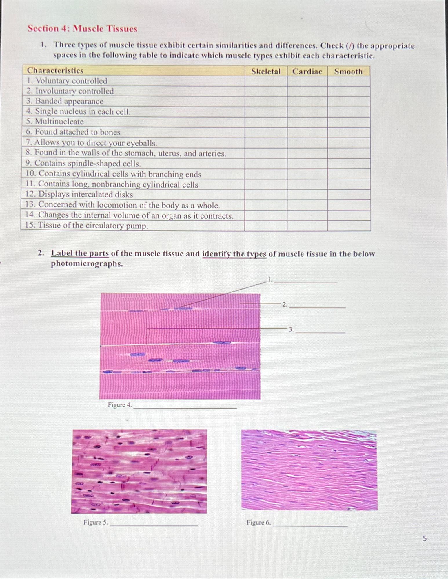 Solved Section 4: Muscle TissuesThree types of muscle tissue | Chegg.com