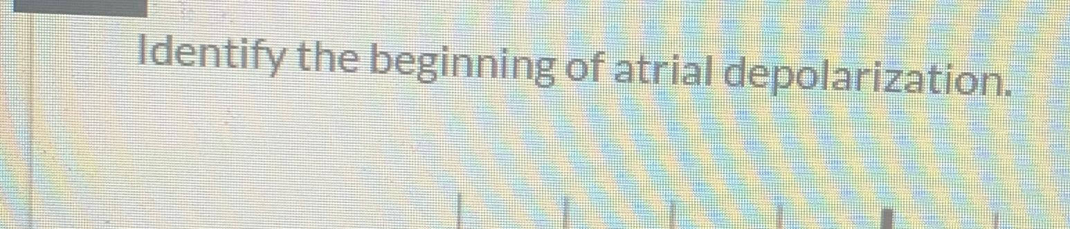Solved Identify the beginning of atrial depolarization. | Chegg.com
