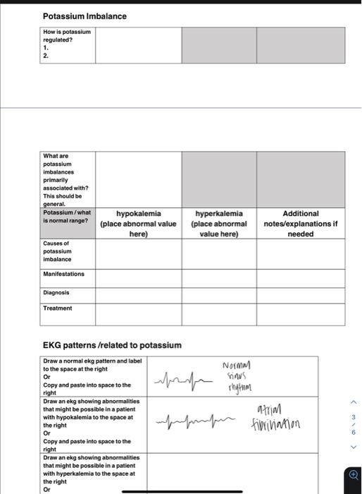 Potassium Imbalance EKG patterns /related to | Chegg.com